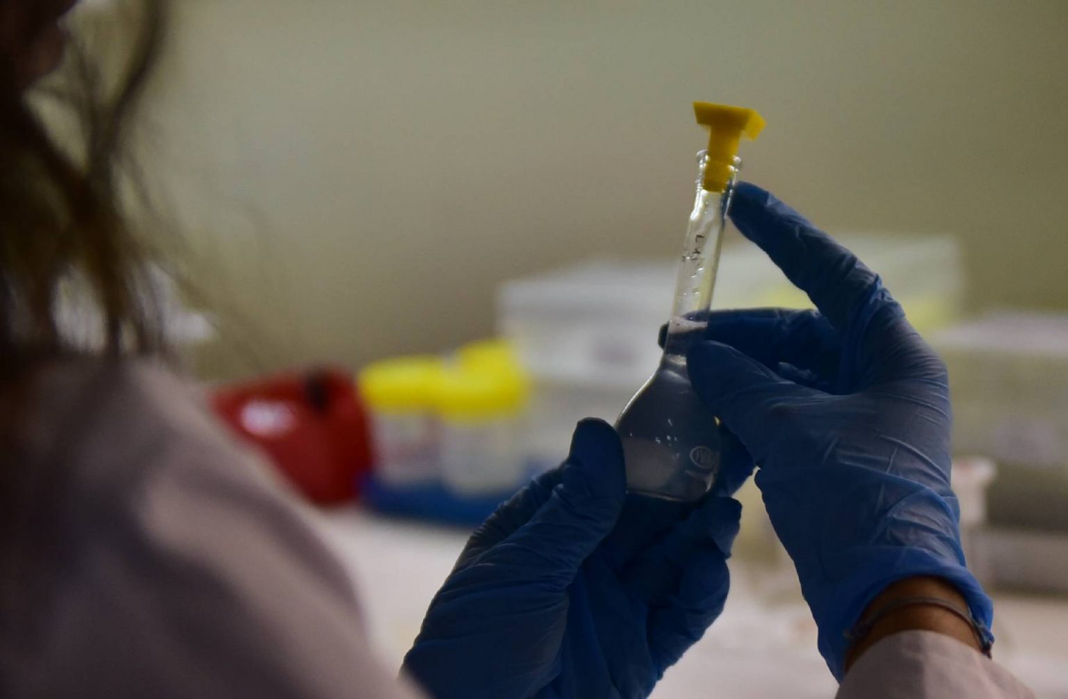 Caracterización y evaluación de quitinasas como potenciales biocidas ...